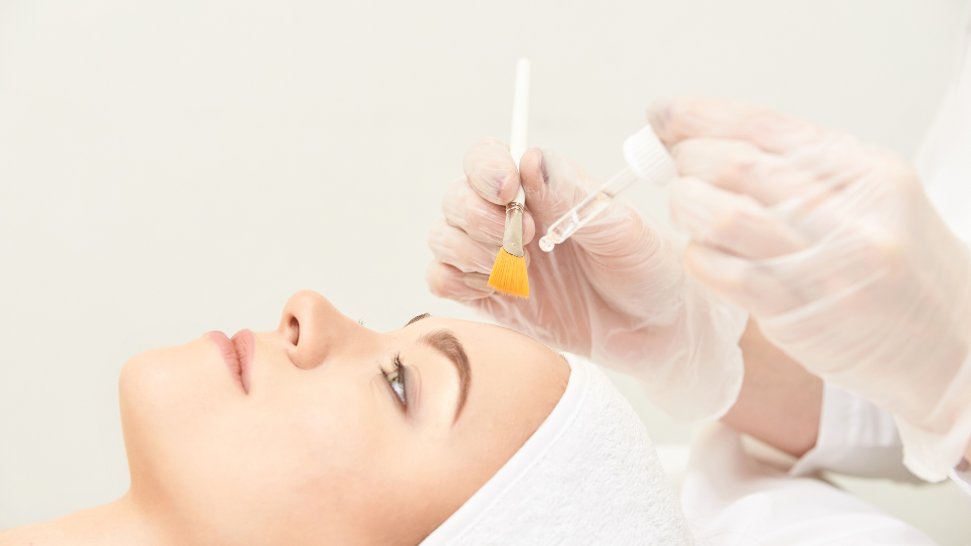 Peeling Médio Profundo – Clínica Médica Thomasi